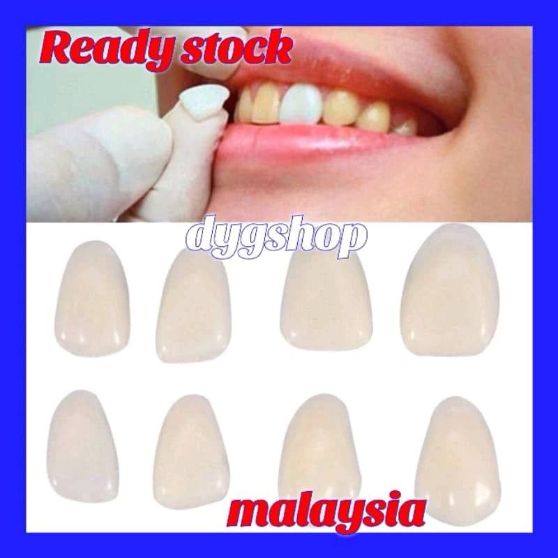 Ready Stock gigi palsu/60pcs_Materials Ultrathin Composite Resin ...