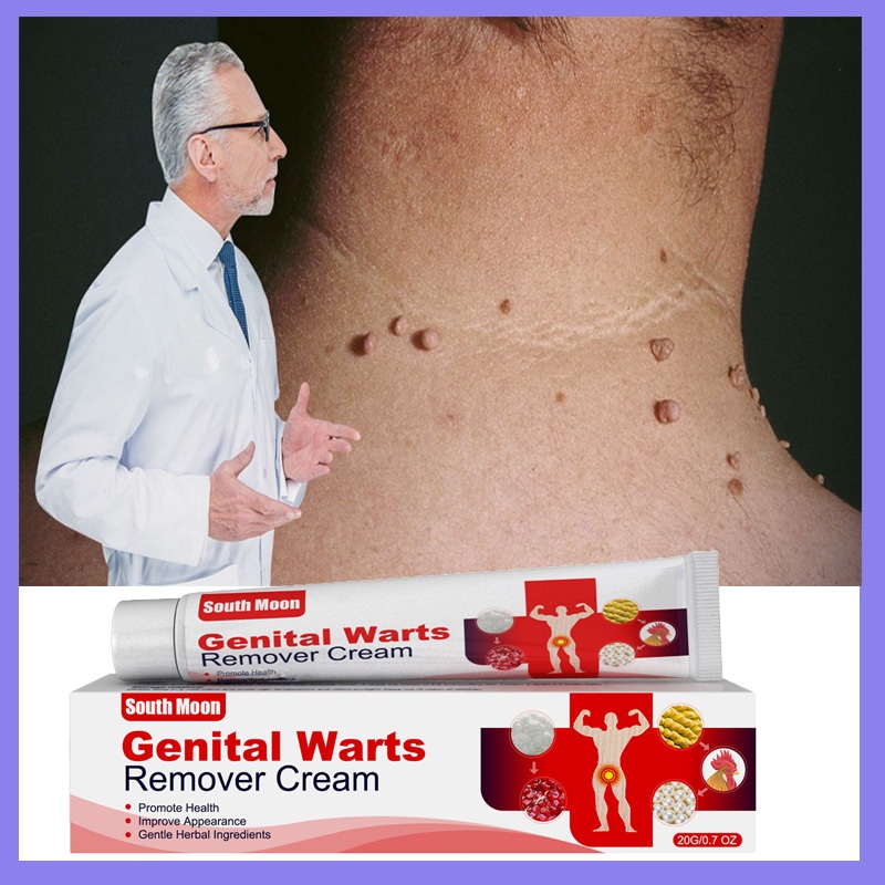 warts removal cream Skin tag genital Warts remover biji kolestrol ...