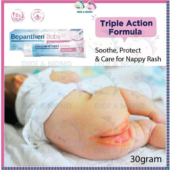Bepanthen Baby Ointment (30g) Nappy Rash Cream Krim Ruam | Shopee Malaysia