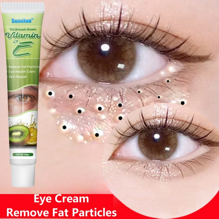 eye cream Fat granule eyebag remover dark circle fat particles eye Wart ...