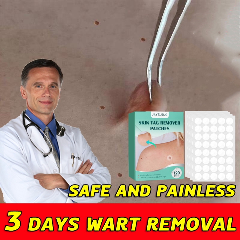 Ubat Ketuat Remover Wart Remover Skin Tag Remover Patch Wart Removal ...