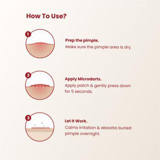ClearUp Microdarts for Acne | Microneedle Patches for Blind Pimples | Pure Hydrocolloid Skincare ...