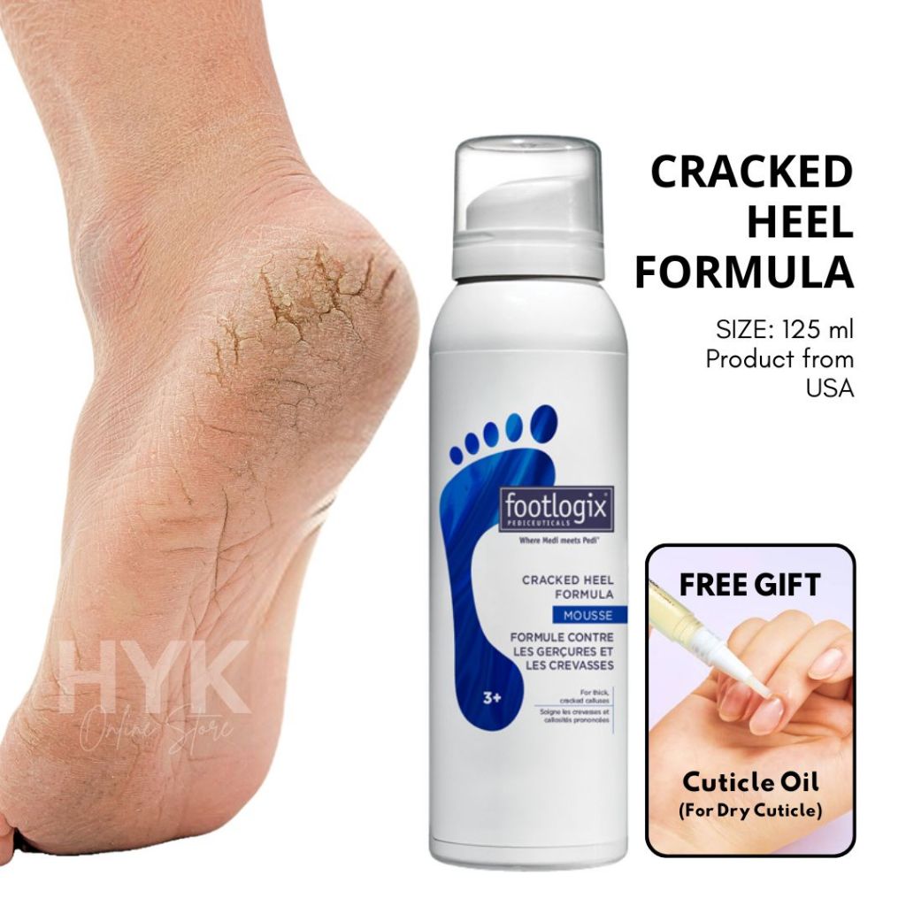 READY STOCK🇲🇾 Footlogix USA CRACKED HEEL FORMULA 3+ Dry Crack Heel Foot ...