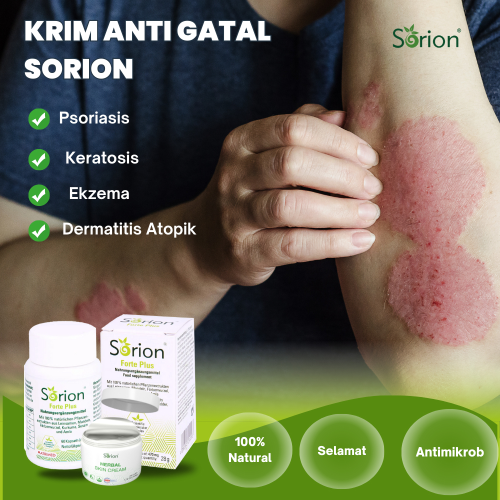 Cream gatal kulit Sorion, krim antibakteria, Salap untuk dermatitis ...