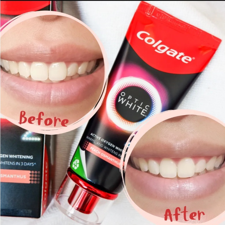 Colgate Optic White O2 Active Oxygen Whitening (85g) | Shopee Malaysia
