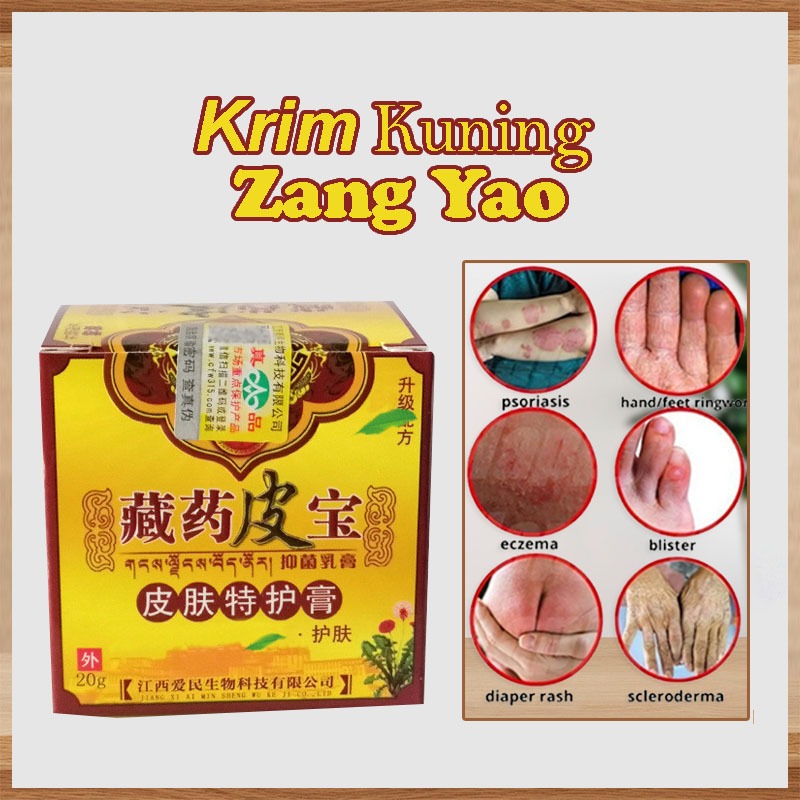 Ekzema Psoriasis Kurap Gatal Kulit Ubat Krim Herba Cina 15g / Eczema ...