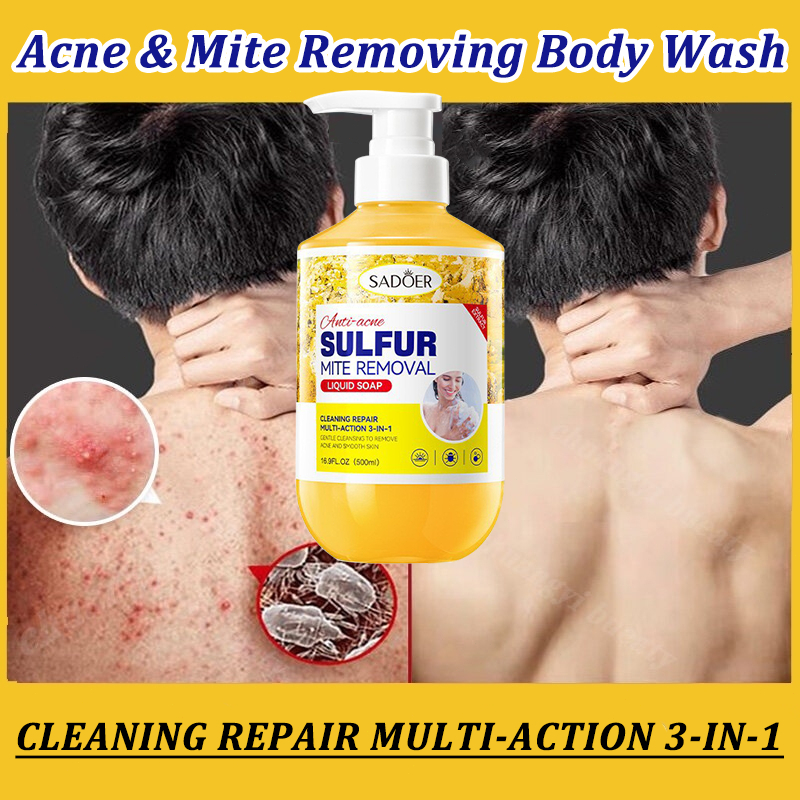 SADOER Sulfur Acne anti bacterial body wash 500ml acne removal ...