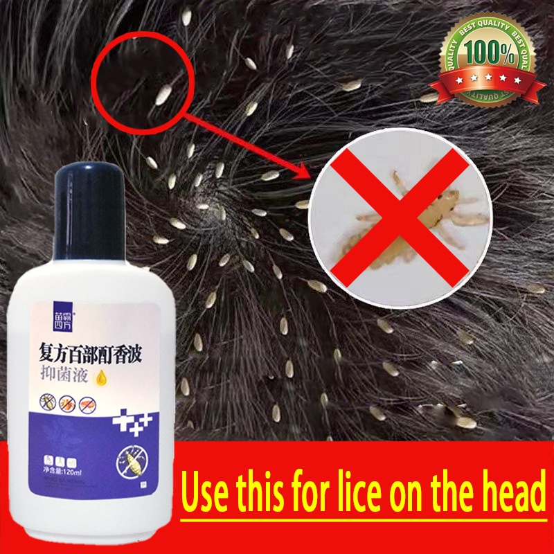 Ubat Kutu Rambut Manusia Shampoo Kutu Rambut Budak Lice Shampoo Syampu ...