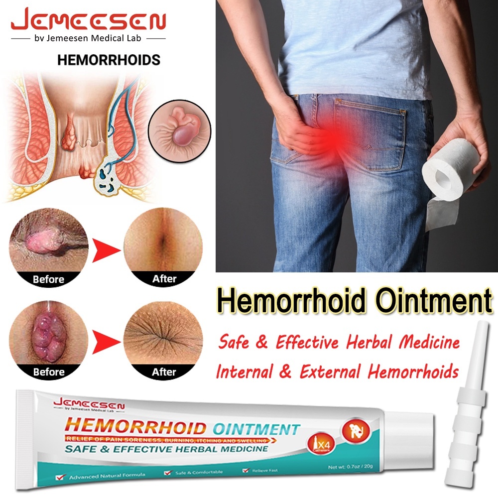 [Local+COD]Hemorrhoids Cream Ubat Buasir Dubur Sakit Gatal Bengkak Berdarah Kecut Buasir ...