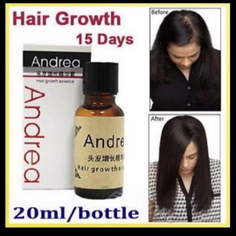 Andrea Hair Growth Serum HAir Treatment | Shopee Malaysia