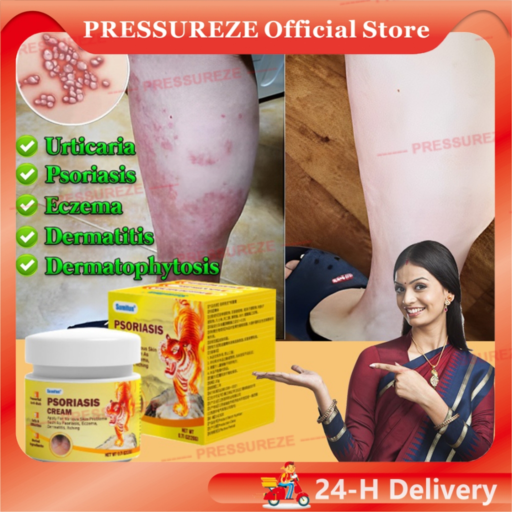 krim gatal kulit psoriasis cream eczema cream Anti Itching Cream ...