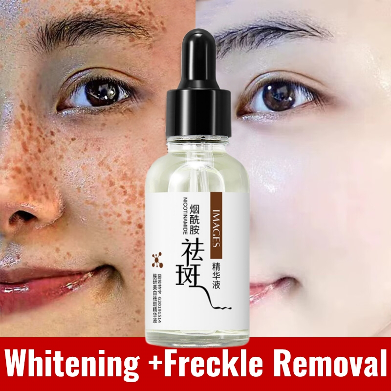 Jeragat Degil Berkesan Serum Jeragat Niacinamide Serum Ubat Jeragat ...