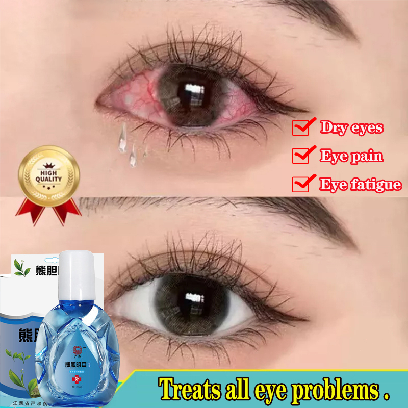 Ubat mata Eye drops for dry eye Ubat selaput mata15ml treatment of dry ...