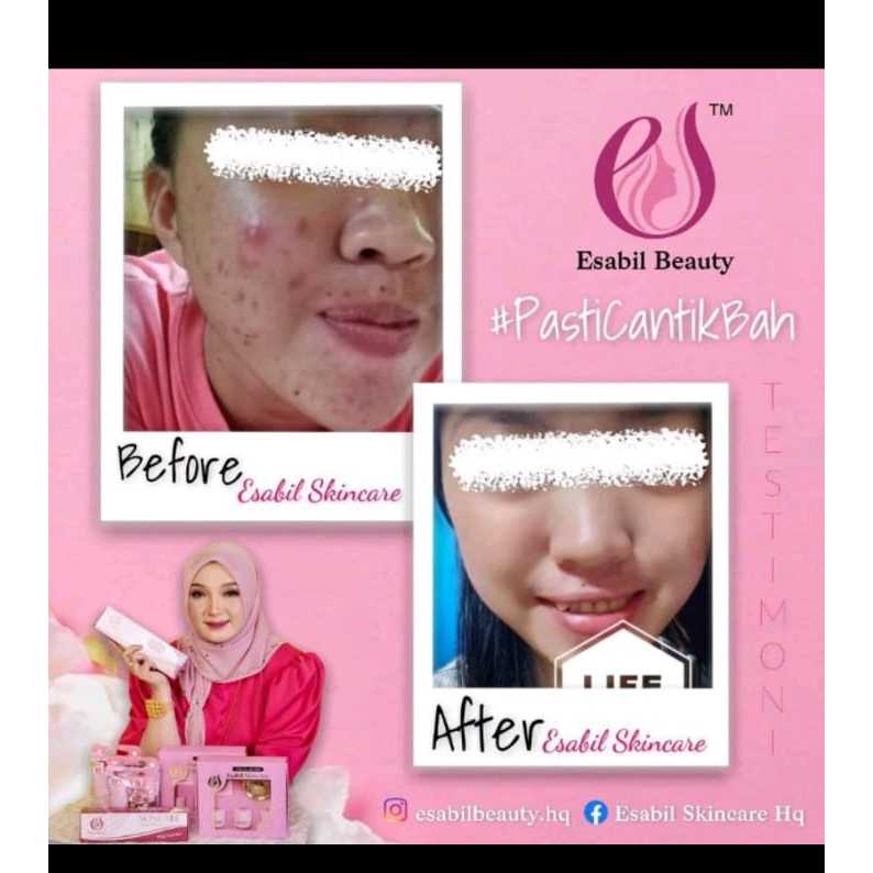 ESABIL SKINCARE SET 5IN1 | Shopee Malaysia