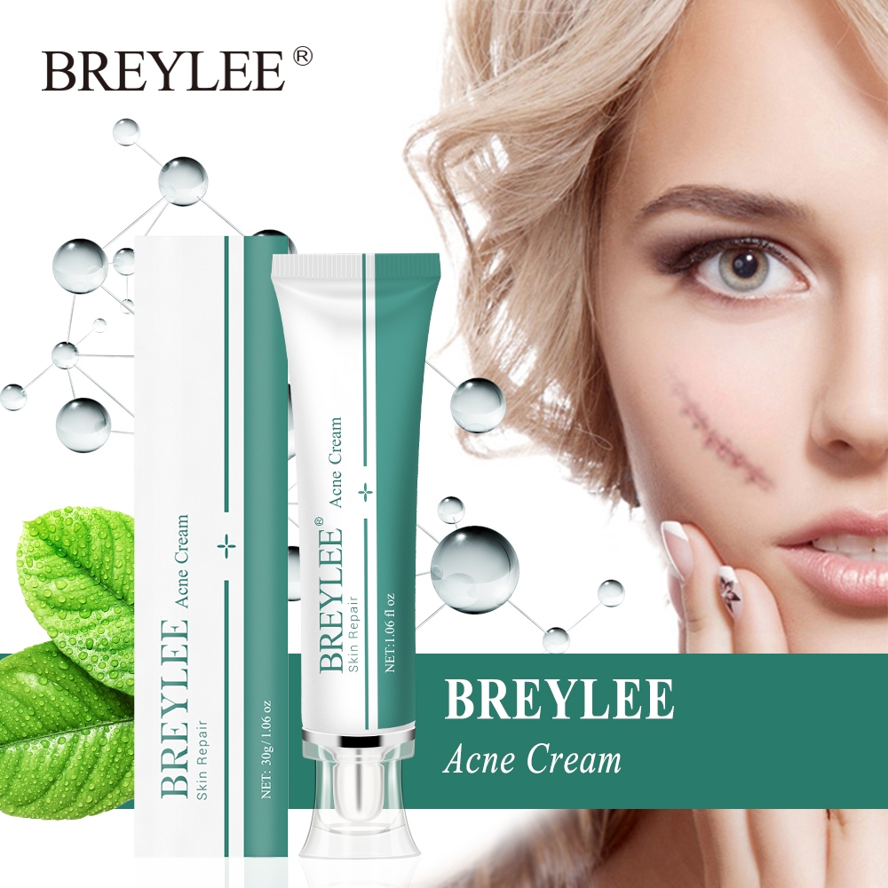 BREYLEE Scar Removal Acne Cream Treatment Remove Stretch Marks Whitening Dark Spot 30g | Shopee ...