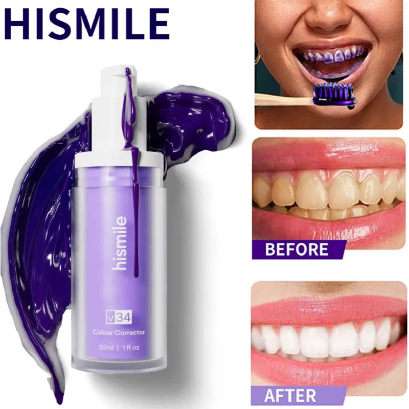 Original Hismile v34 Teeth Whitening Purple Viral - Pemutih Gigi Viral ...
