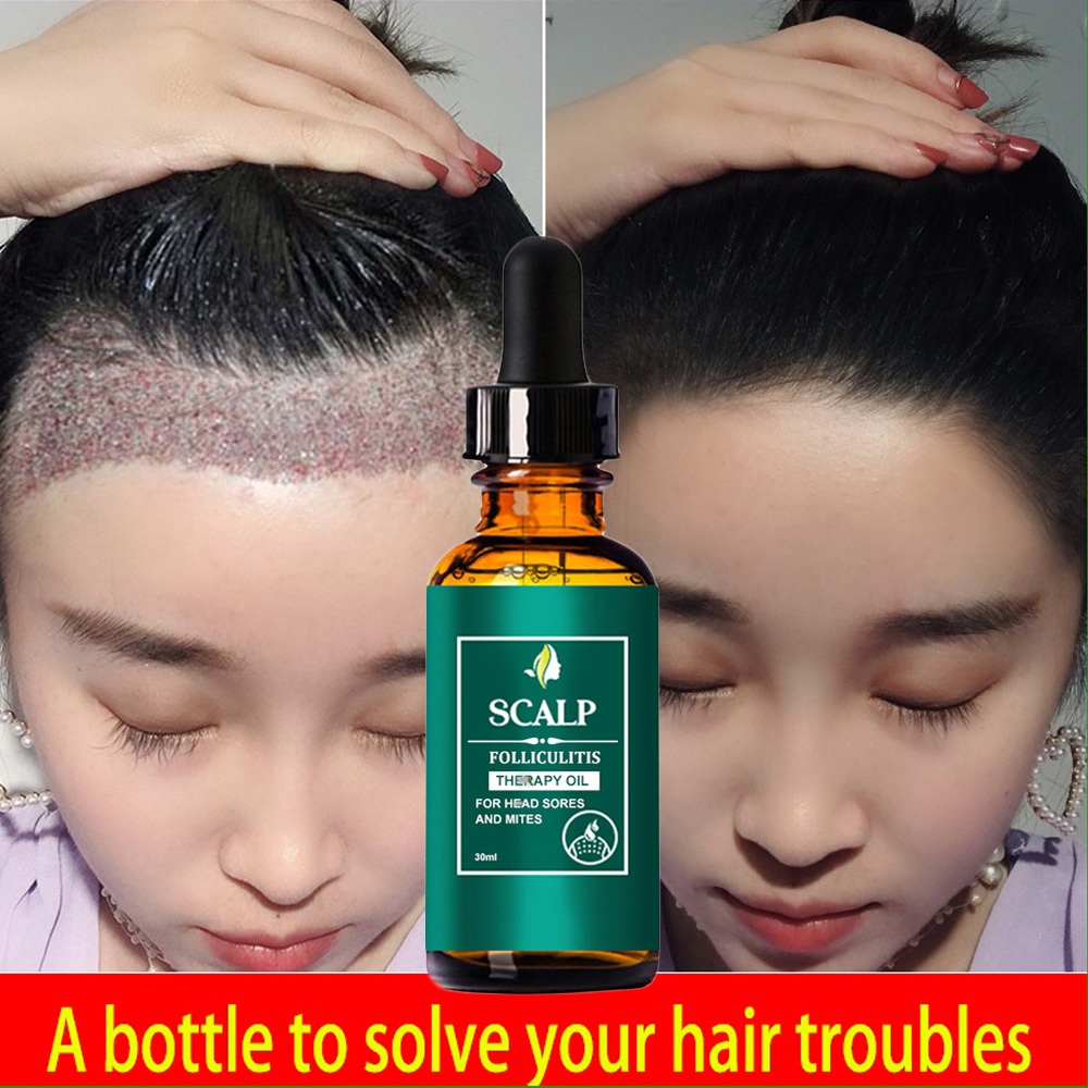 Africa Wild Ginger Hair Growth Essential Oil Crazy Thinnin Spots Loss ...