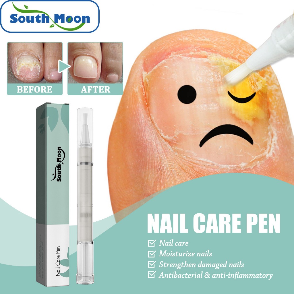 Ubat Kuku Rosak Fungal Nail Fungus Treatment Ubat Kulat Kuku Ingrown ...