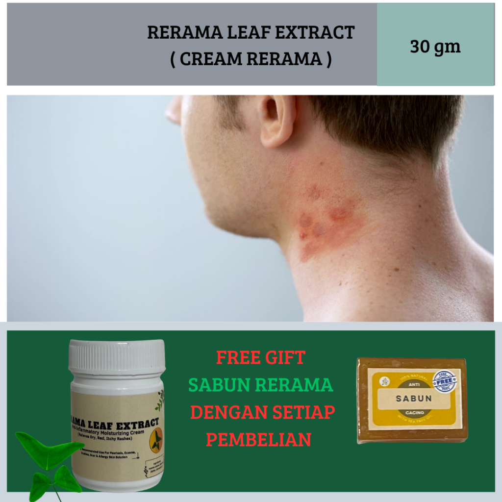 KRIM GATAL DAUN RERAMA - KRIM GATAL RERAMA TERBUKTI BERKESAN UTK ...