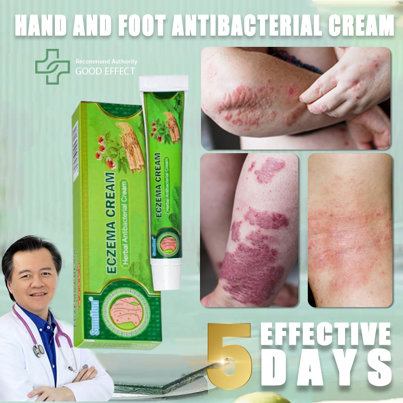 Eczema treatment perfect derma cream psoriasis Antibacterial krim ubat ...