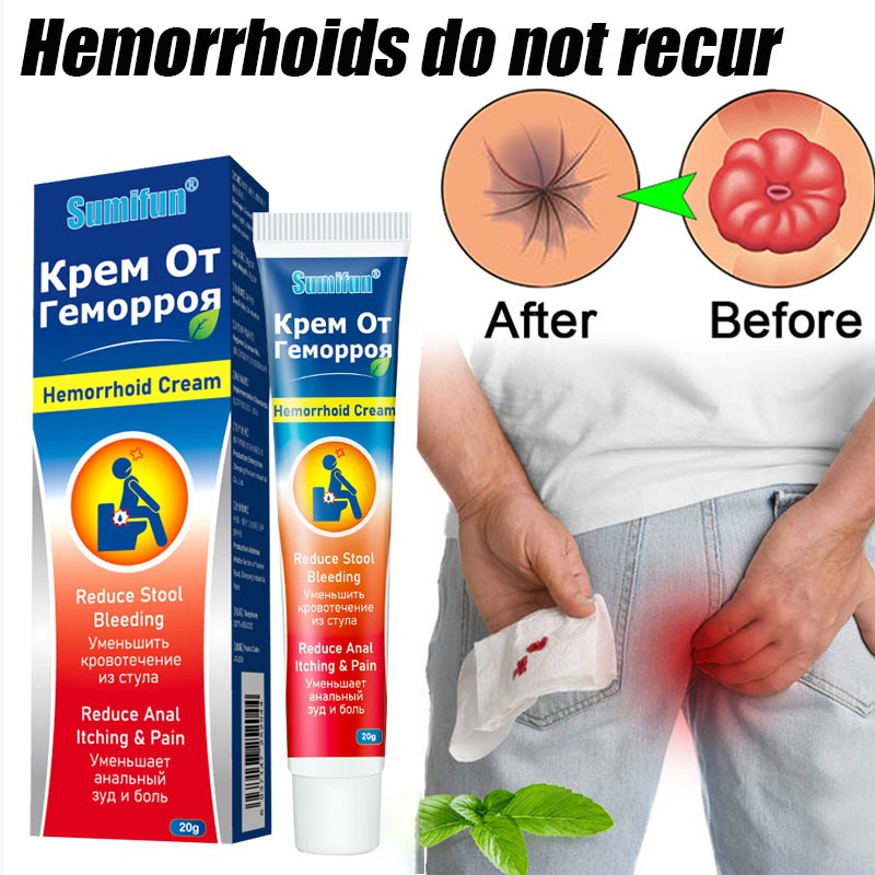 Ubat buasir Krim buasir Hemorrhoids cream Hemors buasir Ubat buasir sapu Hemorrhoids Treatment ...