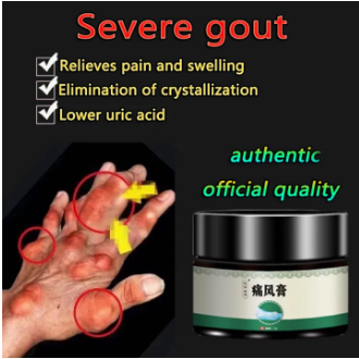 ubat gout lulus kkm gout ointment 35g Joint pain natural herbal anti ...