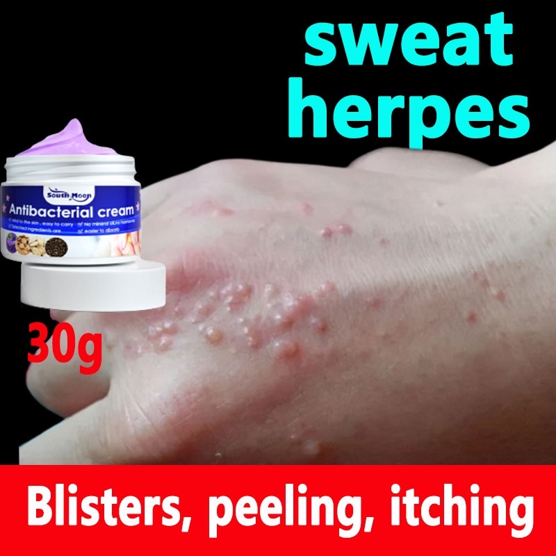krim gatal kulit ubat gatal ubat gatal kulit eczema cream psoriasis ...