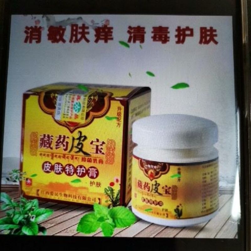 CREAM KRIM GATAL PENYAKIT KULIT ECZEMA KUDIS KURAP PANAU RUAM ANTI ...