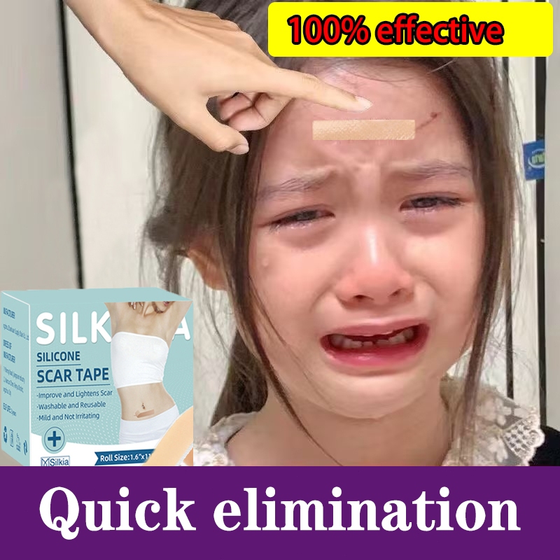 Silicone Scar Sheets Scar Patch- Reusable Silicone Scar Strips Type ...
