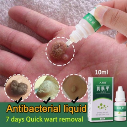 Wart Remover Cream ubat kutil Skin Tag Mole Removal Mole Wart Removal ...