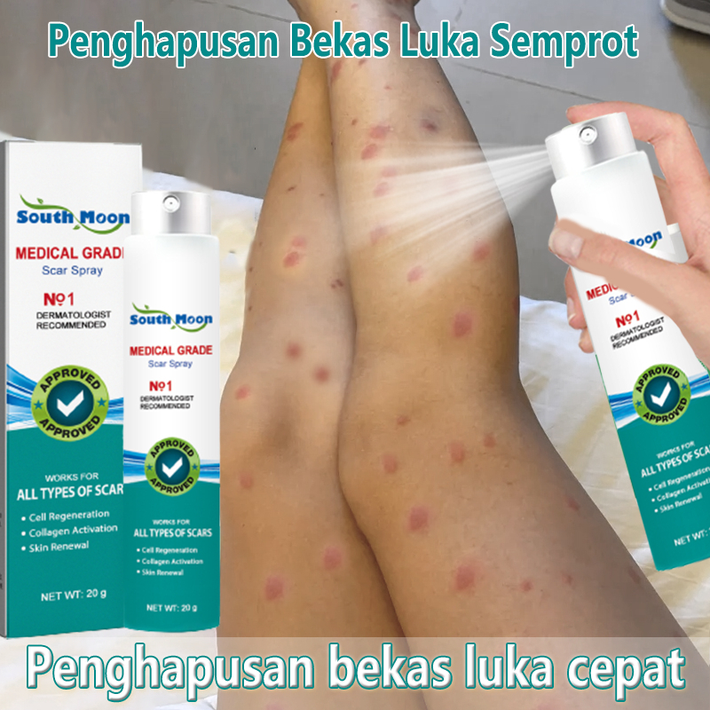 Scar Remover Spray 20ml scar remover Black scab scar remover Fast and ...