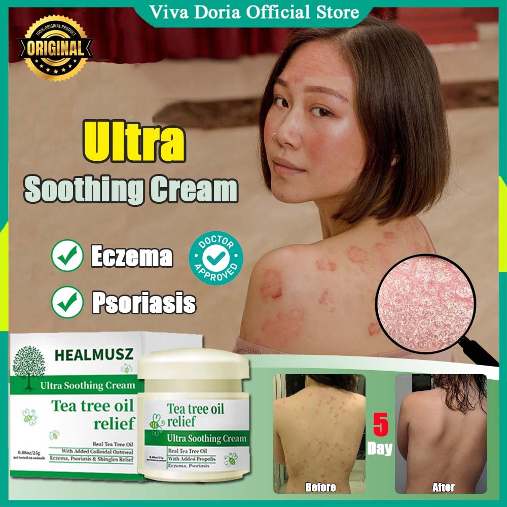 Ultra Soothing Cream Psoriasis Antibacterial Cream Eczematoid Ointment ...