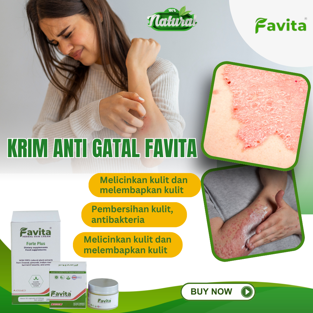 Krim anti-gatal herba Favita, Melegakan psoriasis, Ekzema, Antibakteria ...