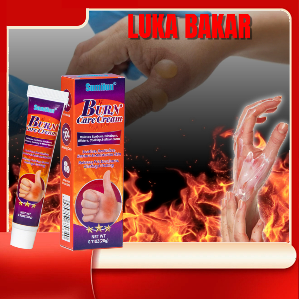 【45% OFF】Burn Care First Aid Cream Antiseptic Wound Healing Cream 烧伤护理膏 ...