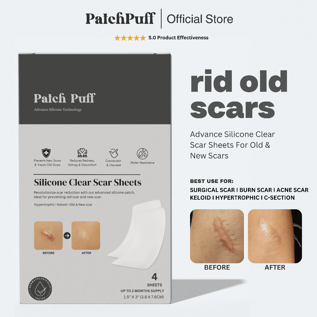 [Patch Puff]Advanced Silicone Clear Scar Sheets 4 Reusable Keloid/Acne ...