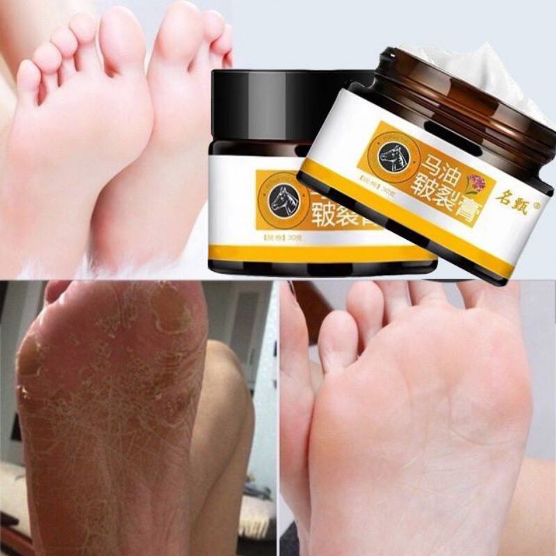 HORSE OIL HANDS AND FEET REPAIR penghalus kulit tapak kaki merawat ...