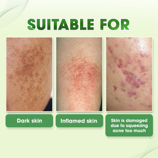 Verble Serum Pitted Scar Reduce dark spots Brighten skin Regenerate ...