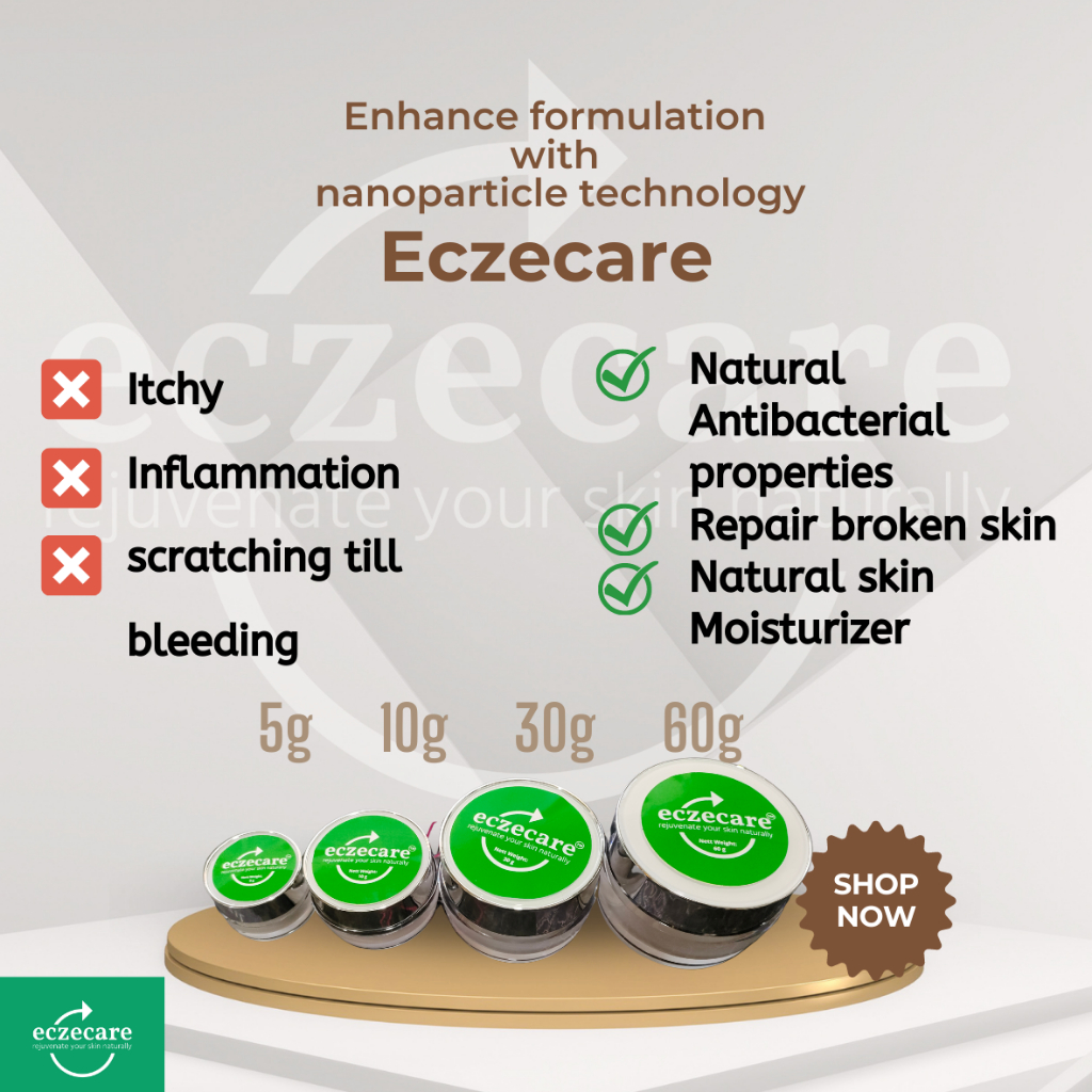 Eczecare® Cream - The Ultimate Natural Skincare Remedy for eczema ...