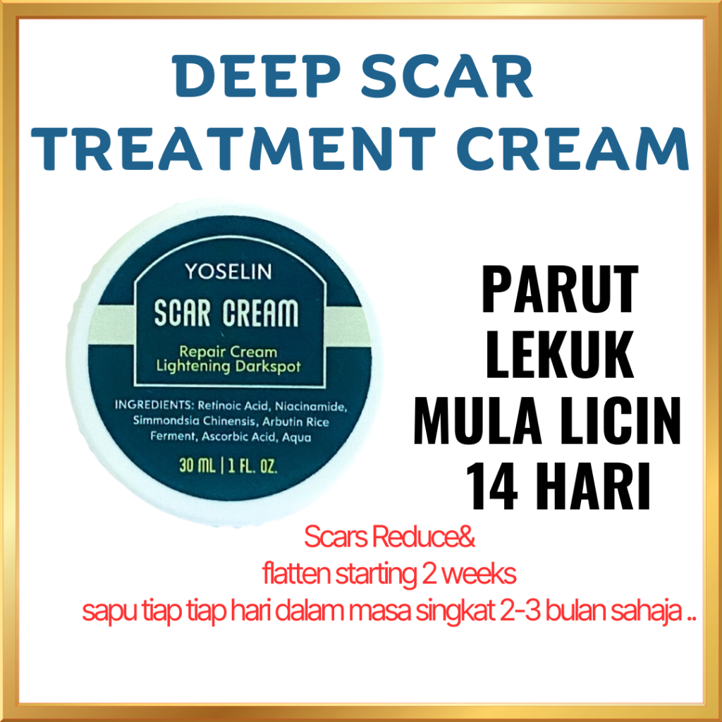 Scar Cream Yoselin® Parut Lekuk Parut Berlubang Acne Scars Skincare ...