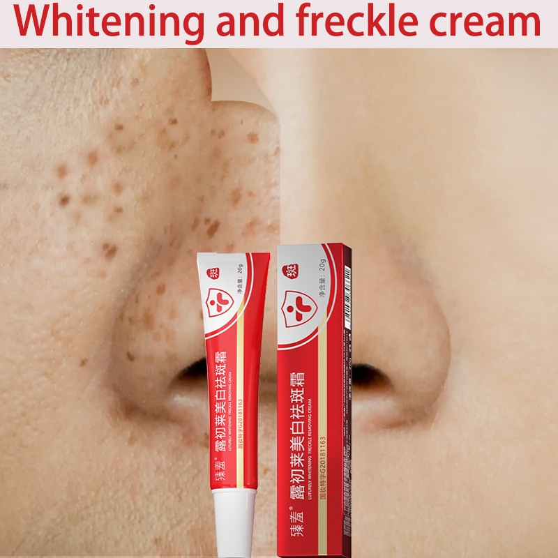 whitening freckle remover cream Whitening freckle cream 美白祛斑霜 30g ...