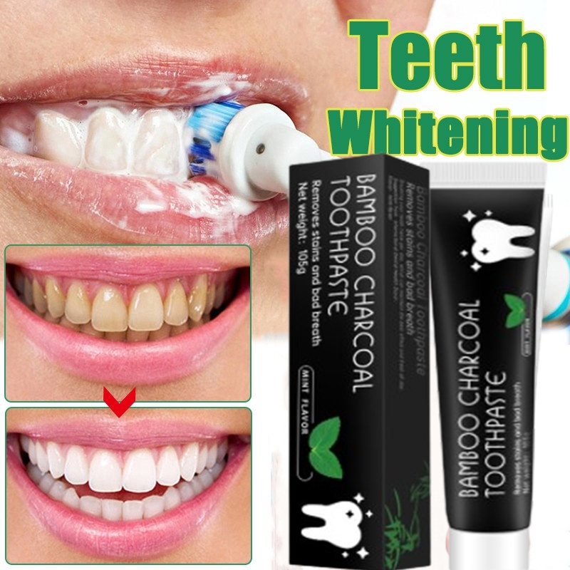Ubat Gigi Whitening Toothpaste Teeth Whitening Oral Care Anti Cavity ...