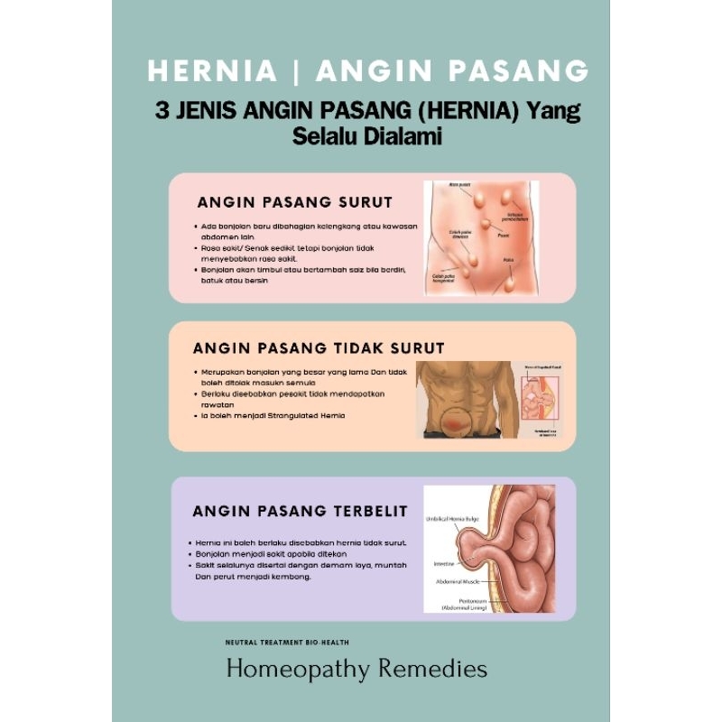 Angin Pasang / Hernia (Homeopathy Neutral Treatment) | Shopee Malaysia