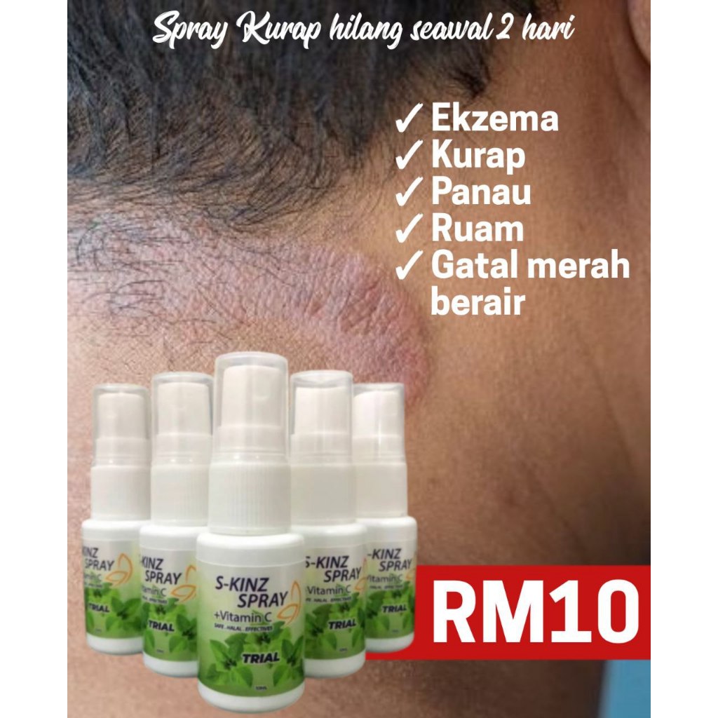 Skinz Spray + vit C Skabies kulit gatal kering parut ekzema kurap panau ...