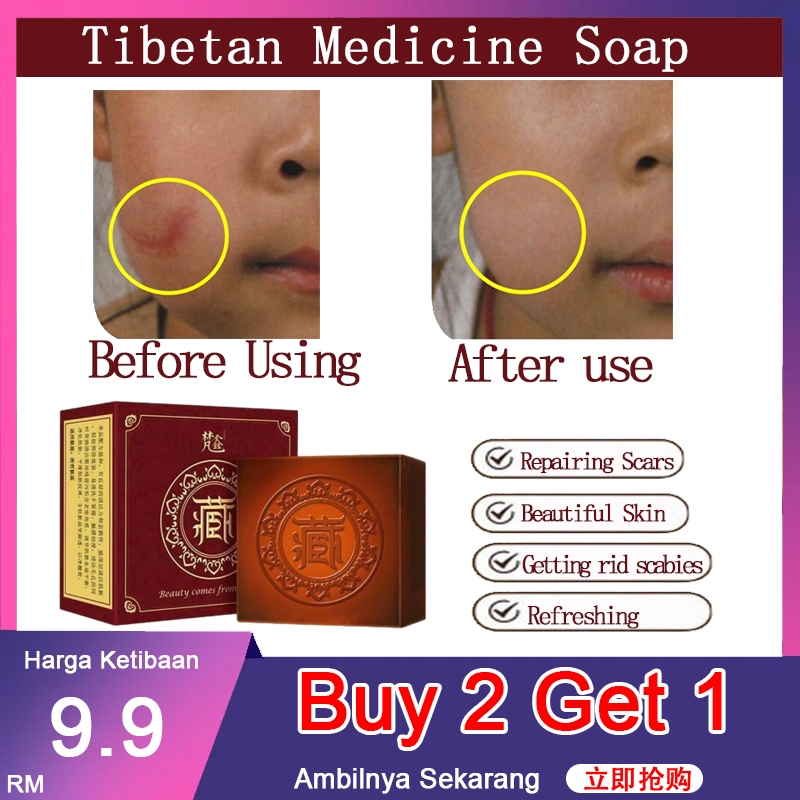 Sabun hilangkan parut Hilangkan Bekas luka lama parut Scar removal soap ...
