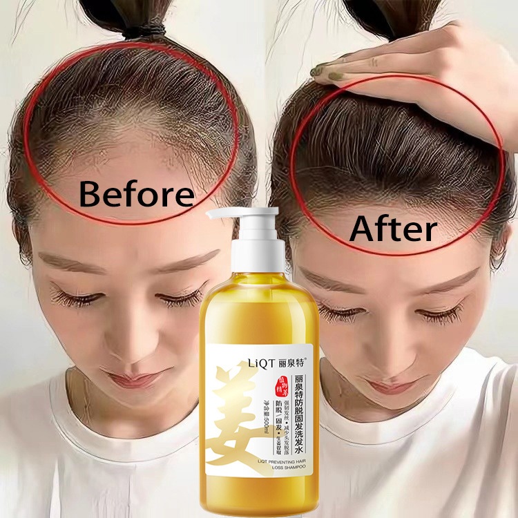 Hair fall shampoo-Shampoo rambut gugur Anti-Hair loss shampoo 500ml ...