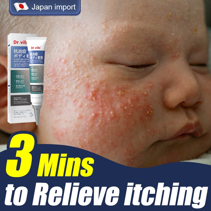 20g Japan Eczema Cream Anti Fungal Moisturizing Itch Relief Whitening Brightening Acne Scar ...