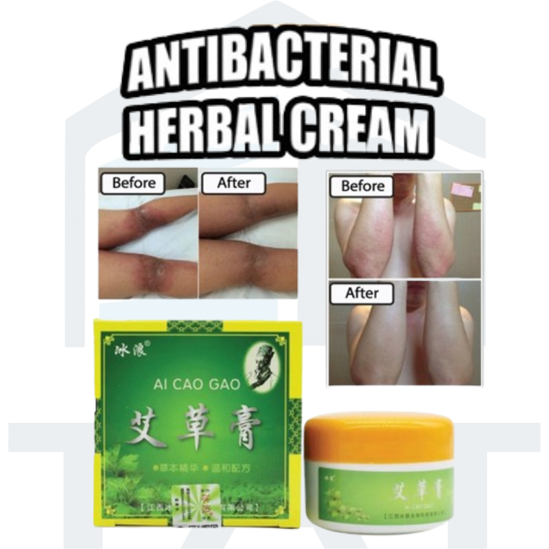Antibacterial skin fungus cream Krim herba hilang gatal celah kangkang ...