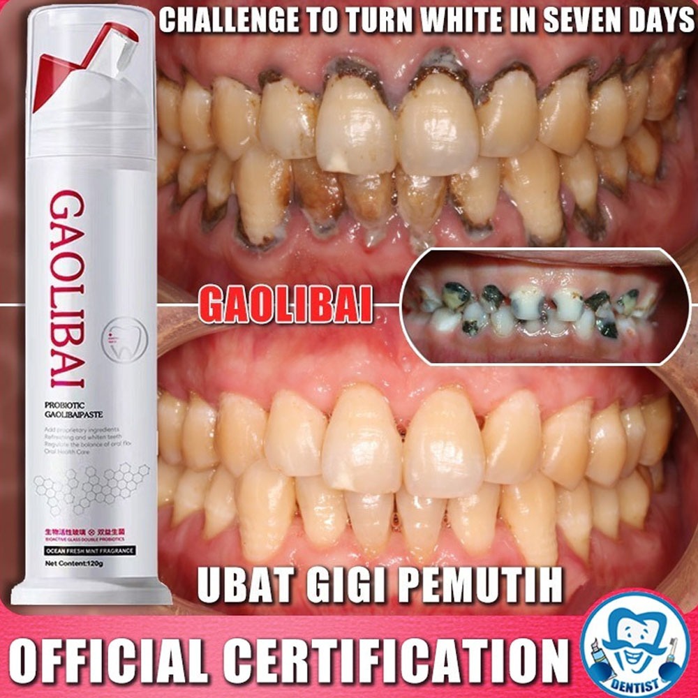 GAOLIBAI ubat gigi pemutih Seaweed Active Peptide Double Whitening ...