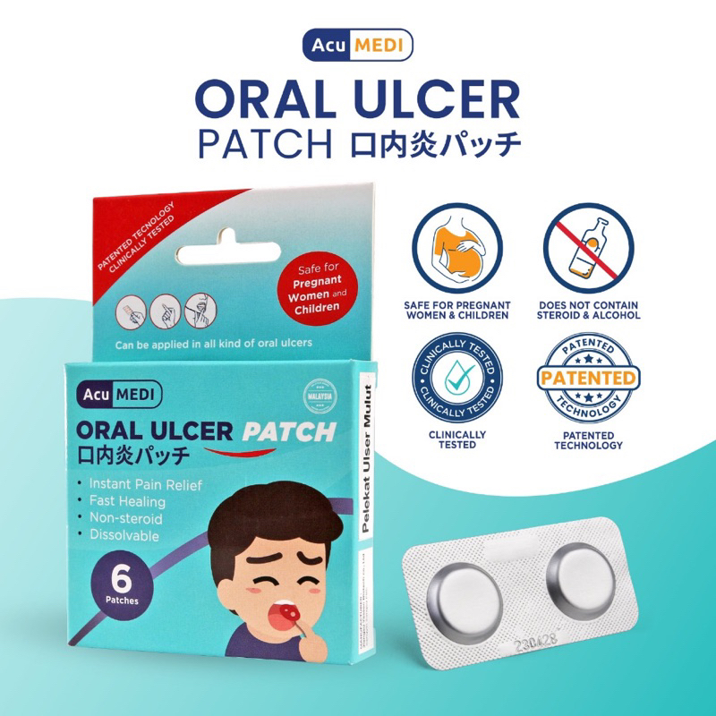 {READYSTOCK} Oral ulser patch for treatment | Shopee Malaysia