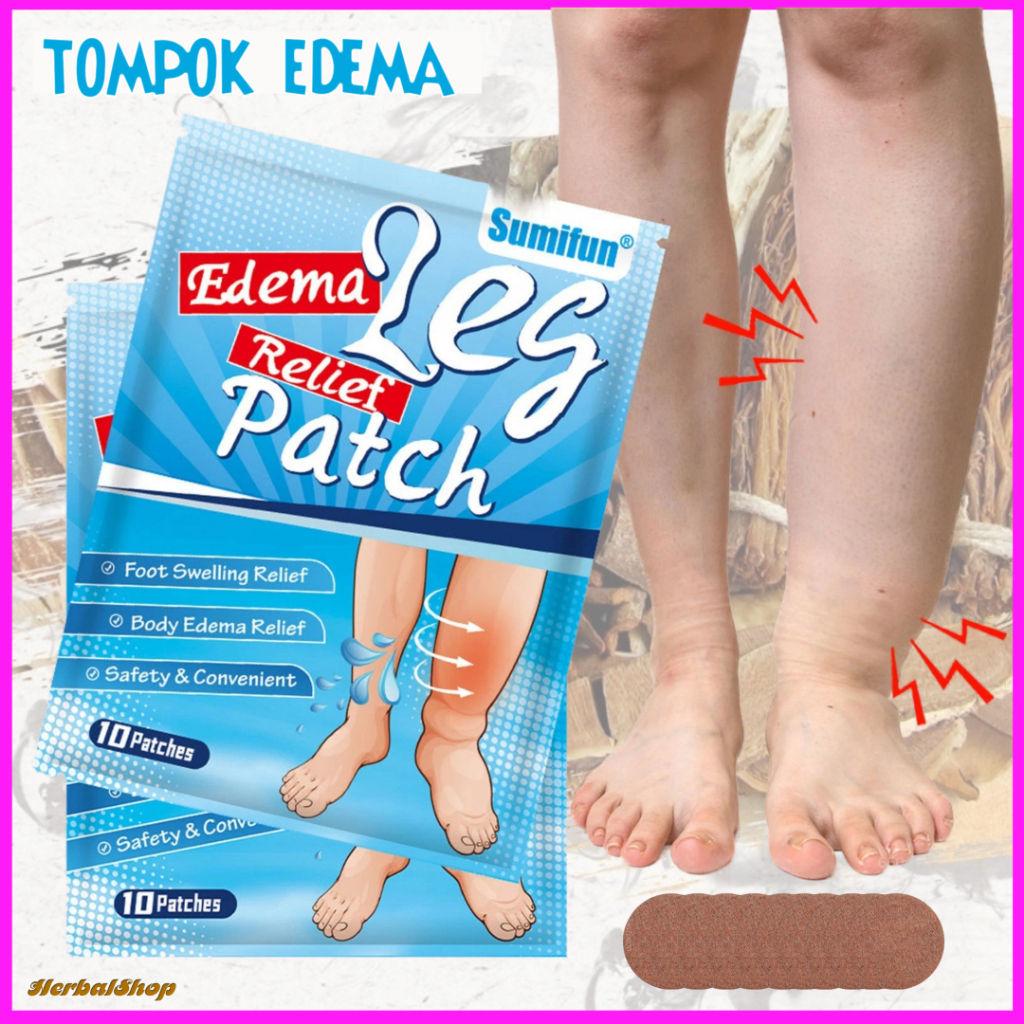Tampalan Edema Sumifun Bengkak Kaki Melegakan Sakit | Shopee Malaysia